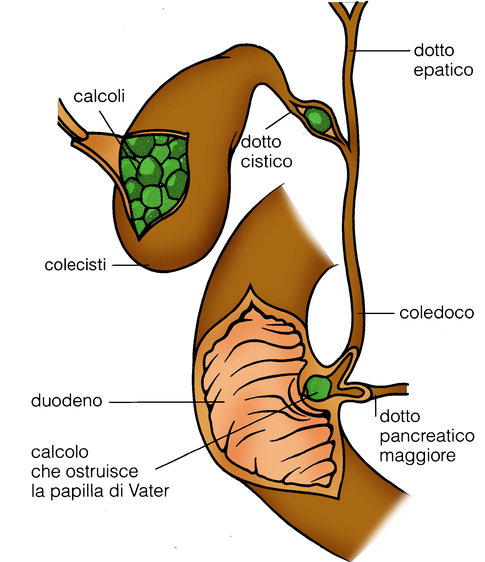 Calcolosi biliare :: Nutraceutica e Aloe Vera